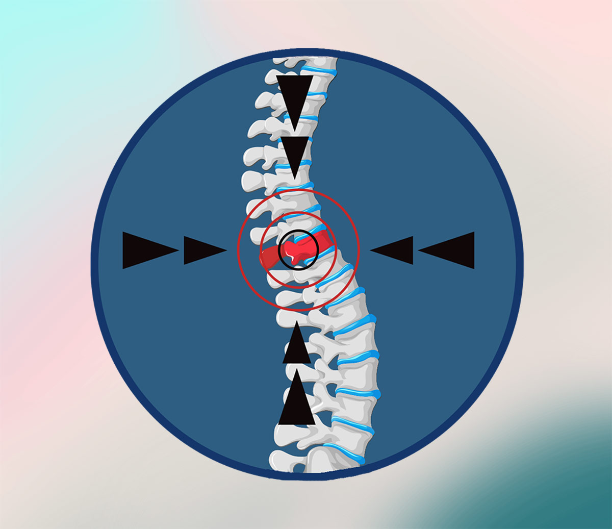 Spinal Decompression Raab Chiropractic Spinal Decompression Raab Chiropractic